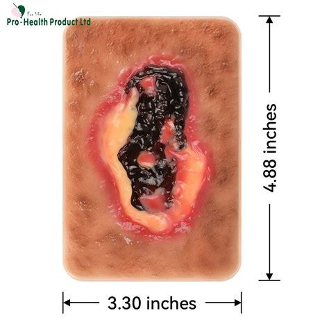 3 Types Of Necrotic Tissue Model Pocket Wound Card For Wound Care Education