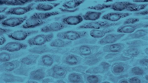 Epidermolysis Bullosa Independent Resources Medthority