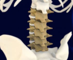 Lumbar Medial Branch Block Pain Management Pain Solutions Medical