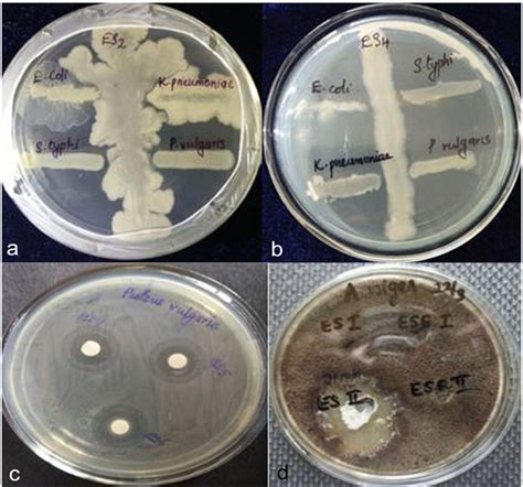 Antimicrobial And Antioxidant Potential Of Endophytic Bacteria Isolated From Emilia Sonchifolia