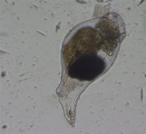 8 Questions With Answers In Rotifera Science Topic