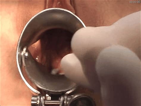 Medical Gyno Enema Fetish Nurses Doctors Patients Page 5