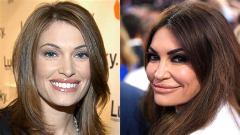 Why Kimberly Guilfoyle Has The Worst Case Of Mar A Lago Face