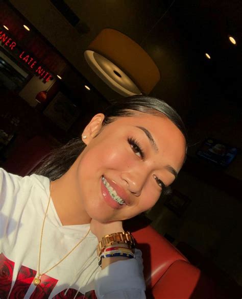 Pin By Nuu On Brace Face Cute Braces Braces Teeth Colors Cute Girls