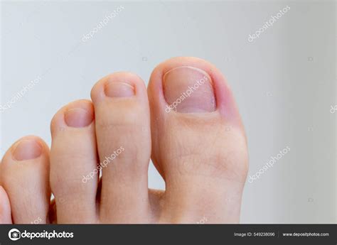 Healthy Toes