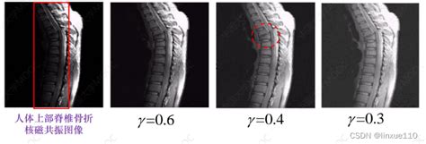 图像增强之灰度变换与代数运算利用灰度变换实现对眼底图像图1的增强处理实验非线性变换时γ取不同的值比较 Csdn博客