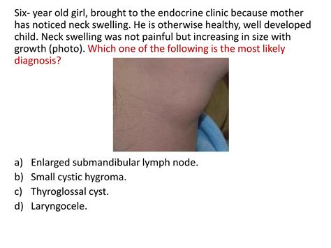 Pediatric Endocrine Review Mcqs Part 5 Pdf