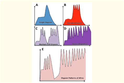 A Classical Female Orgasm Pattern Defined In The Classical Medical Download Scientific