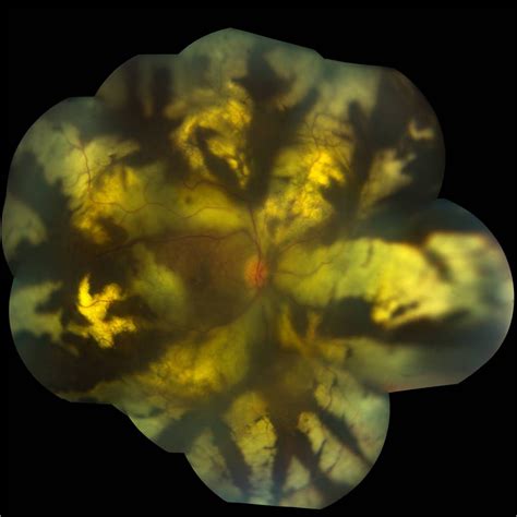 Rahna Rajan Posted On Linkedin