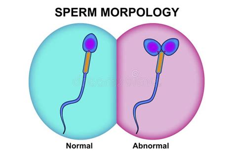 Sperm Morphology Comparison Between Normal And Abnormal Stock