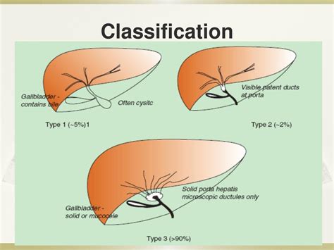 Ppt Biliary Atresia Powerpoint Presentation Free Download Id3821371 Ppt Biliary Atresia Powerpoint Presentation Free Download Id3821371