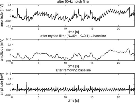 Figure 2 From A New Method Of Saccadic Eye Movement Detection For
