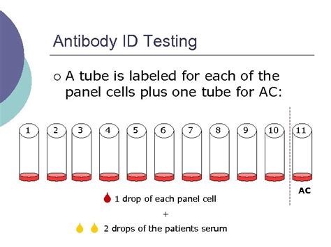 Antibody Identification Renee Wilkins Ph D Mls Ascp Cm Cls