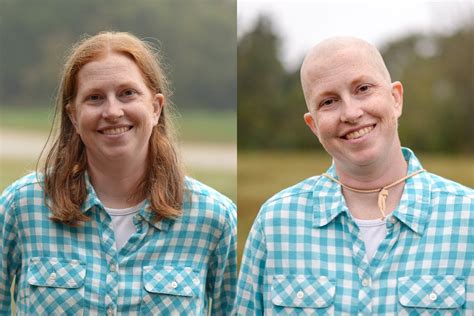 Before And After Chemotherapy