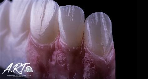 Jack Marrano Miyo World