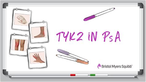 Tyk2 Tyrosine Kinase 2 Pathway