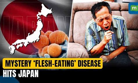 Аюултай халдварын тохиолдол Японд өссөөр байгаа ч мэргэжилтнүүд яагаад гэдгийг тайлбарлаж