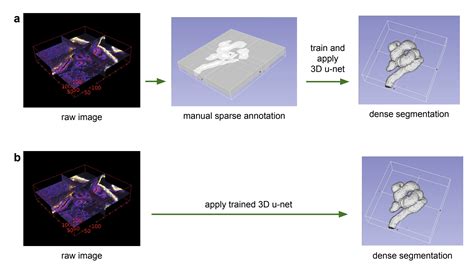 3d U Net 논문 리뷰