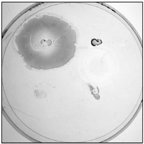 Twitching Motility A Baumannii Twitching Motility After 24 H Of