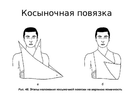 Презентация к уроку Первая помощь при травмах верхних конечностях