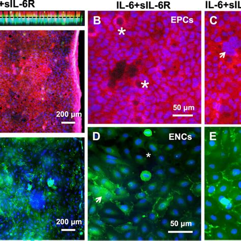 Effects Of Treatments With Il 6 Sil 6r 500 Ng Ml Vs Download