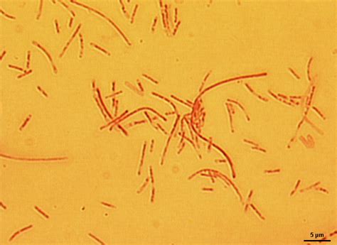 Miniatlas Mikroorganismů