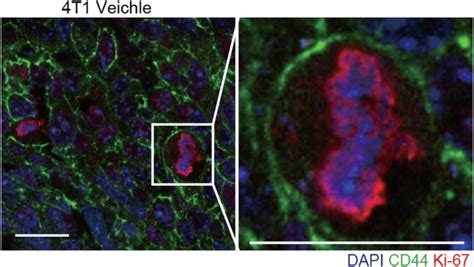 Correction Modulation Of Oxidative Phosphorylation Augments Antineoplastic Activity Of Mitotic
