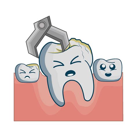 Illustration Of Tooth Extraction 36531023 Vector Art At Vecteezy