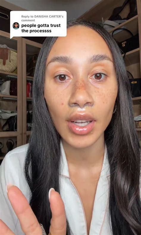 Influencer Eva Gutowski Documents Lip Flip On Tiktok Despite Troll
