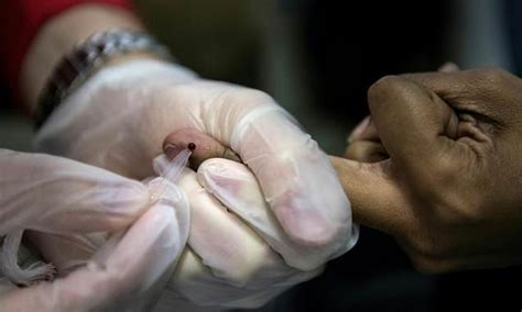 Sex Diseases In US Surge To Record High Daily Mail Online