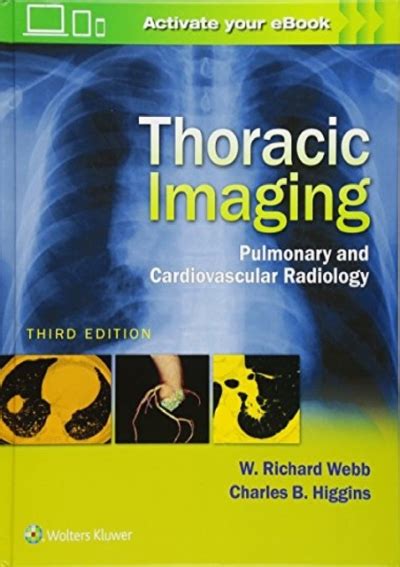 DOWNLOAD PDF Thoracic Imaging Pulmonary And Cardiovascular Radiology