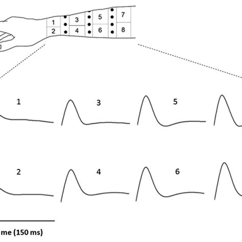 Sample Displacement Time Responses Proximal Distal Axis For Each Of