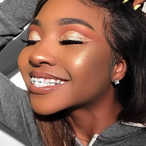 315 Best Brace Face Images On Pinterest Baddies Brace Face And Bracelets