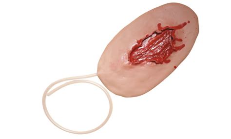 Avulsion Bleeding Wound Advanced Trauma Training Model Medical X