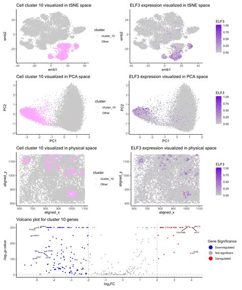 Spatial Transcriptomics Reveals A Distinct Epithelial Cell Population