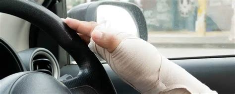 Driving After Upper Limb Injury Sydney Physio Clinic
