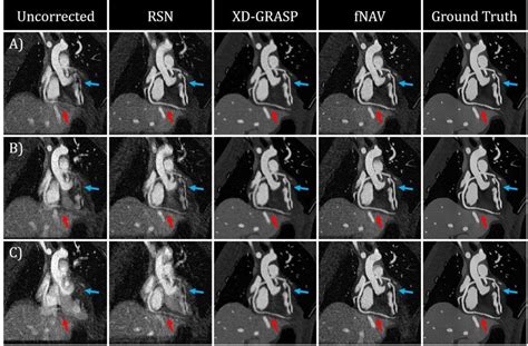 Curved Reformats Of Simulated Data Reconstructions At Increasing Levels