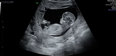 13 15 Weeks Pregnancy Update Gender Reveal And 4d Ultrasound — Jenn