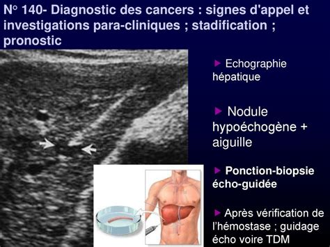 Préparation Aux Ecn Imagerie Médicale Ppt Télécharger