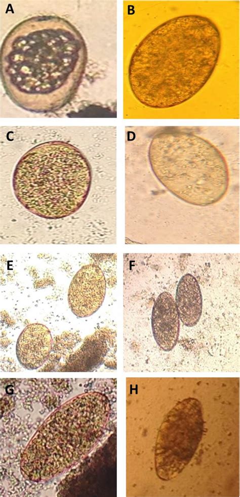 Light Microscope Of Fasciola Gigantica Eggs Treated With Different Download Scientific Diagram