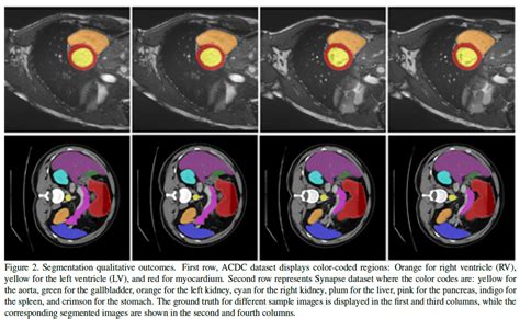 WACV MIST Medical Image Segmentation Transformer With Convolutional Attention Mixing