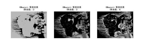 【基于kmeans、kmeans和二分k均值算法的图像分割】数据挖掘实验三 Csdn博客