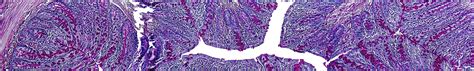 Scanningtma Oncology Tissue And Imaging Services