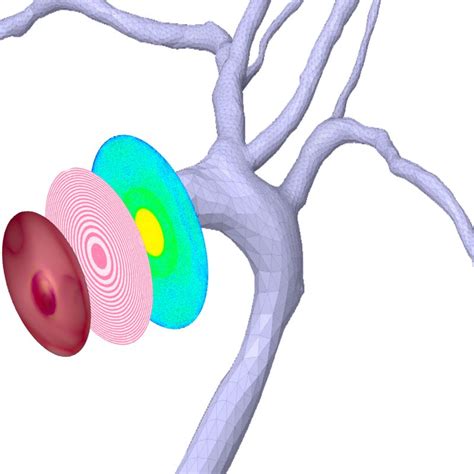 Ansys Optics Photonics Medicalimaging Endoscopy Metalens Ansys