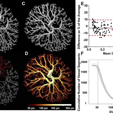 Automated Vascular Segmentation Methodology And Validation A