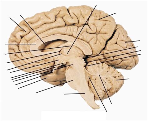 Brain Anatomy Cadaver Anatomy Brain Practical Ankiweb