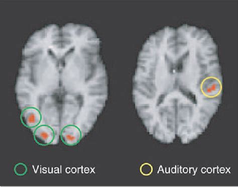 Figure 3 From Multisensory Processing In Sensory Specific Cortical Areas Semantic Scholar