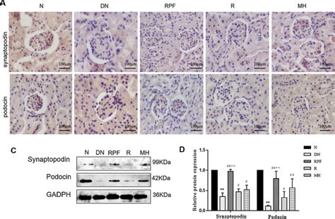 rpf protects glomerular podocytes in vivo immunohistochemistry of