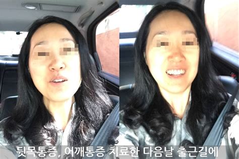 뒷목이뻐근한증상 왼쪽어깨통증 계속된다면 목어깨통증 때문에 밤잠 설치고 응급실 실려가고…상상도 못할 통증이죠 루이빈치과 오는 분들은 물리치료 마사지 침치료