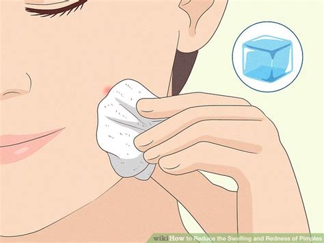 Ways To Reduce The Swelling And Redness Of Pimples WikiHow
